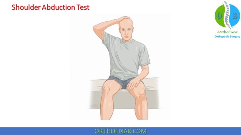 Shoulder Abduction Test (Bakody Sign) | 2025