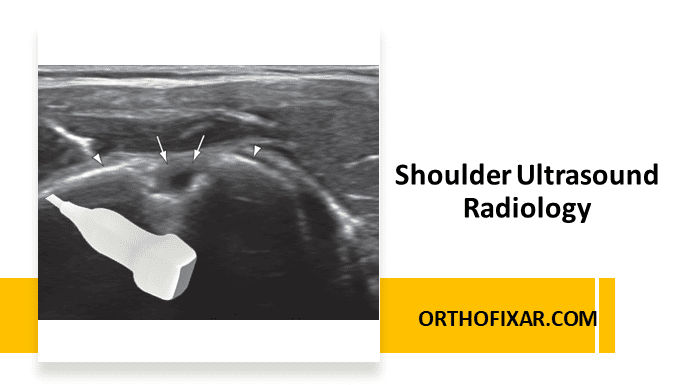 Shoulder Examination Easy Tutorial | OrthoFixar 2025