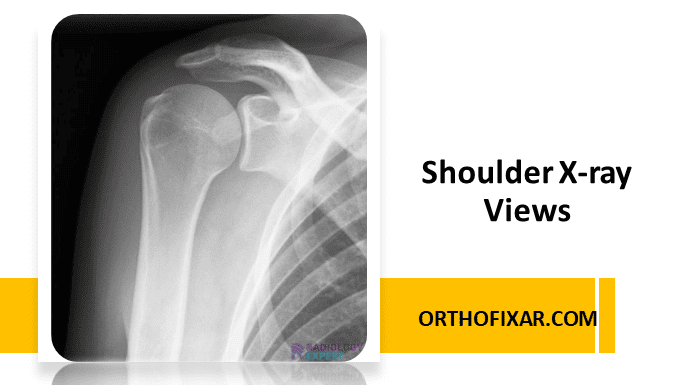 Shoulder X-ray Views | OrthoFixar