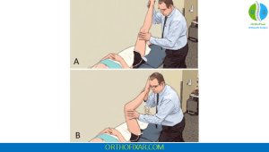 Sign Of The Buttock Test
