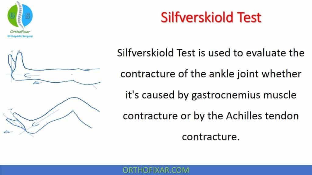 Special Test Category: Ankle & Foot Examination | OrthoFixar