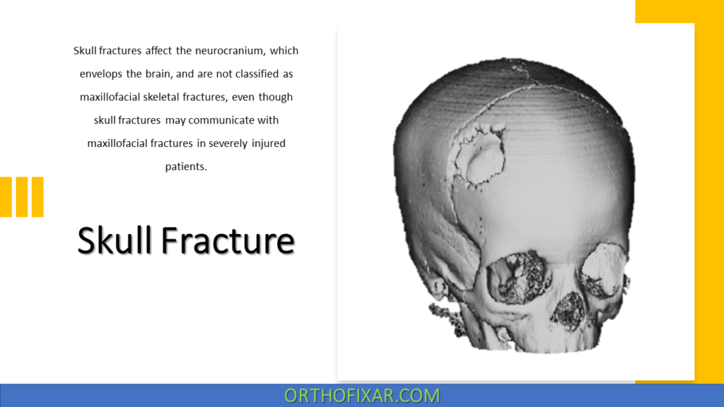 Skull Fracture Overview & Treatment | OrthoFixar
