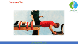 Sorensen Test Explained Easily | OrthoFixar