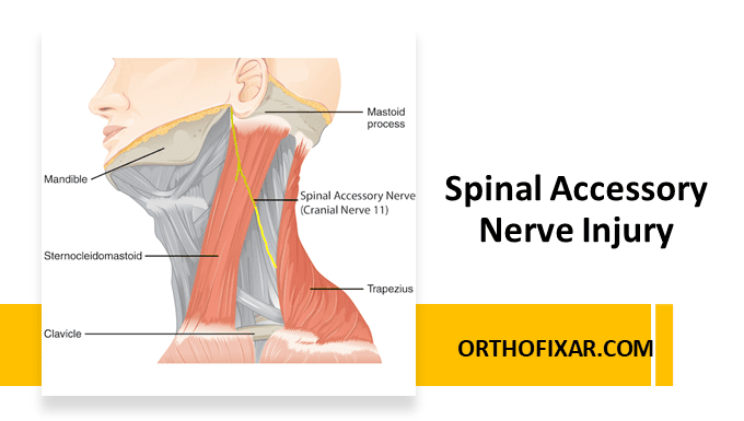 Spinal Accessory Nerve Injury | OrthoFixar
