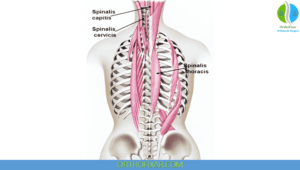 Spinalis Muscle Anatomy | OrthoFixar