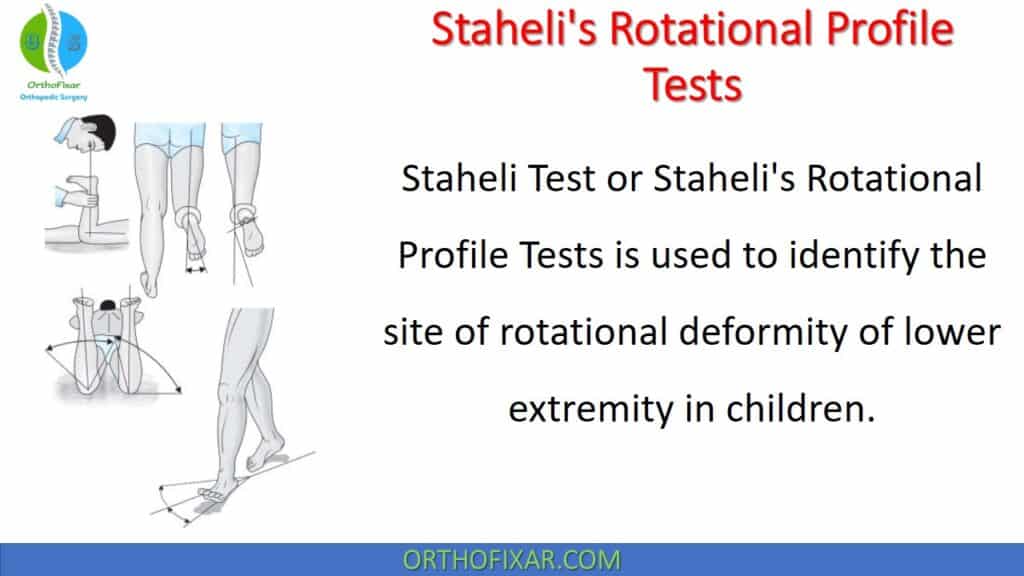 Homans Sign Test