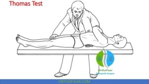 Thomas Test Definition, Technique & Reliability 2025