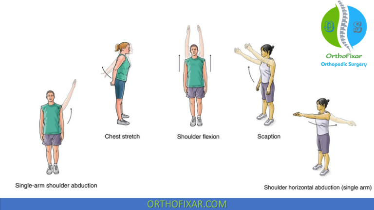 Sternoclavicular Joint Dislocation