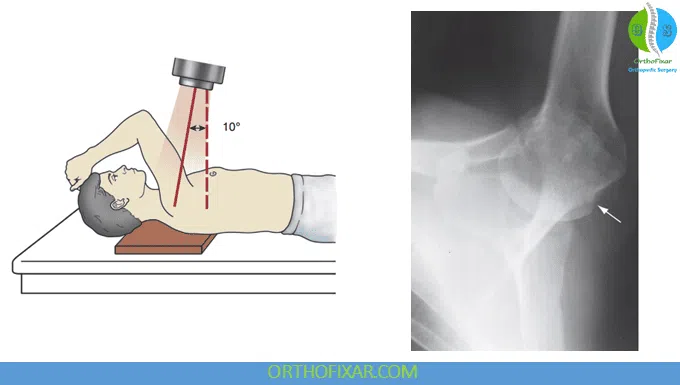 Shoulder X-ray Views