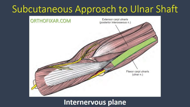 Subcutaneous Approach To Ulnar Shaft