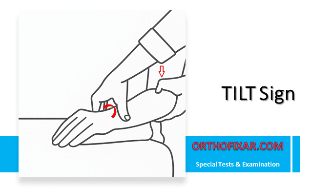Homans Sign: Definition, Technique & Clinical Significance