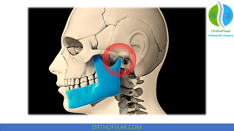 TMJ Injection Technique Easily Step-By-Step | OrthoFixar