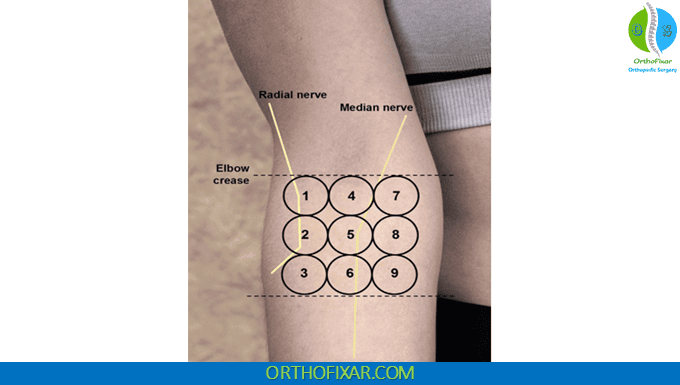 The Rule Of Nine Test For Pronator Syndrome Explained Easily | OrthoFixar