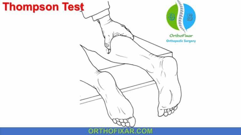 Thompson Test • Easy Explained | OrthoFixar 2025