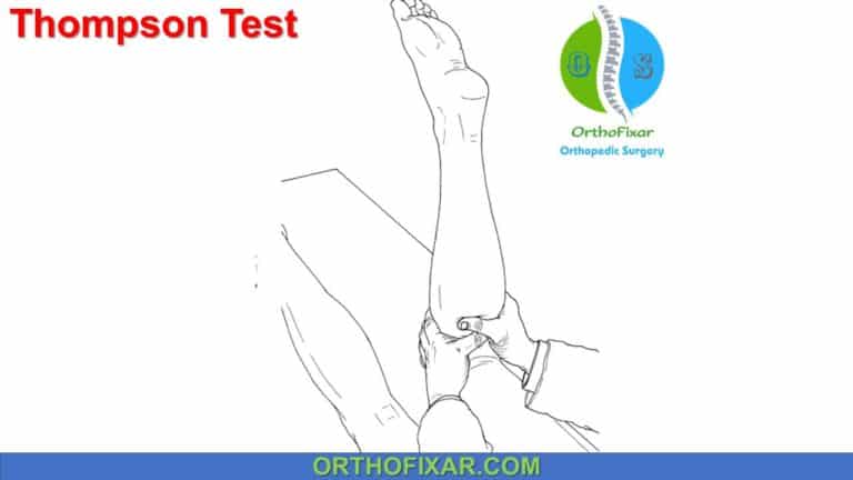 Thompson Test • Easy Explained | OrthoFixar 2025