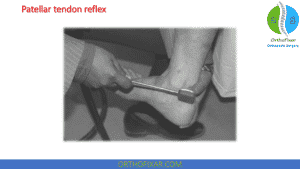 Lumbar Spine Nerve Roots
