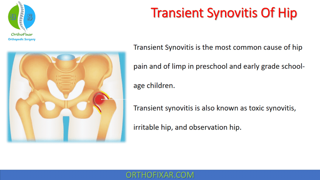 Transient Synovitis In Children Overview