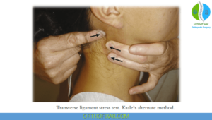 Transverse Ligament Stress Test Explained Easily | OrthoFixar