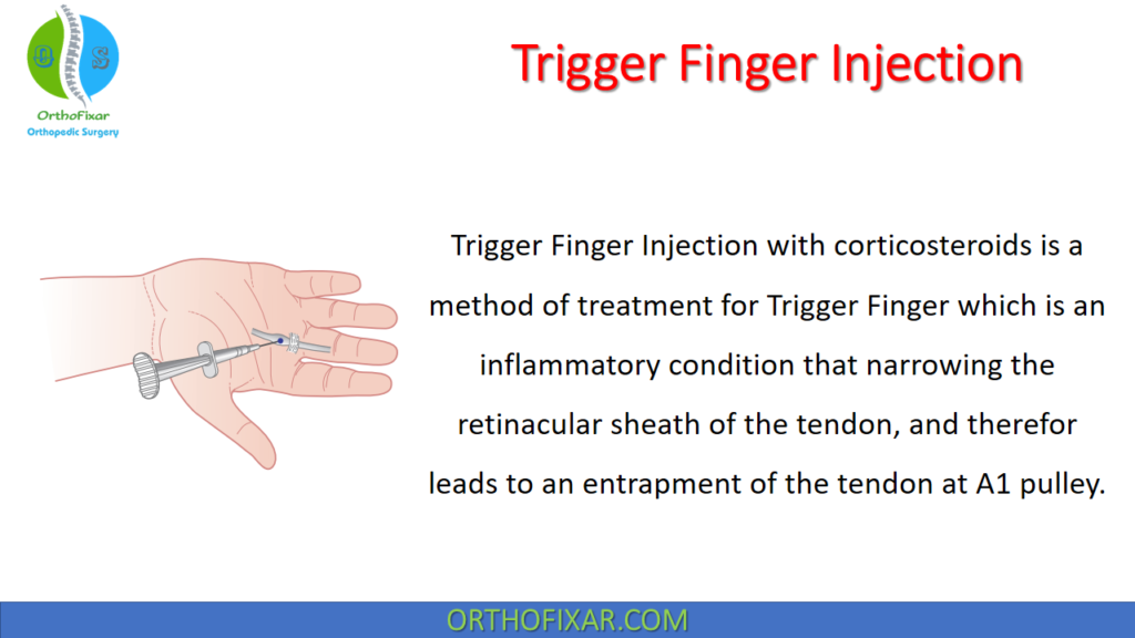 Trigger Finger Injection Easily Step-By-Step | OrthoFixar