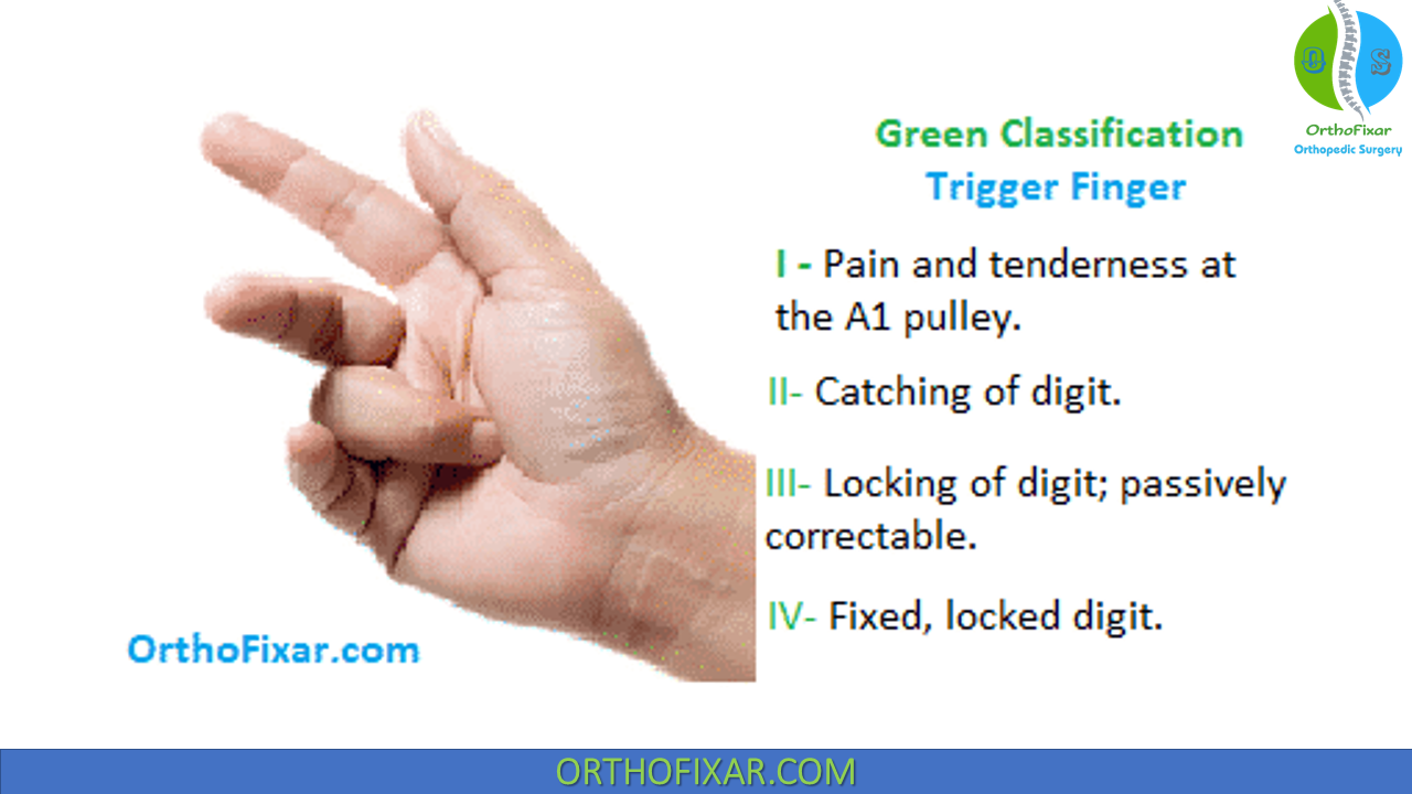 Green Classification Of Trigger Finger | OrthoFixar 2025