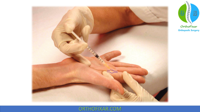 Trigger Finger Injection Easily Step-By-Step | OrthoFixar