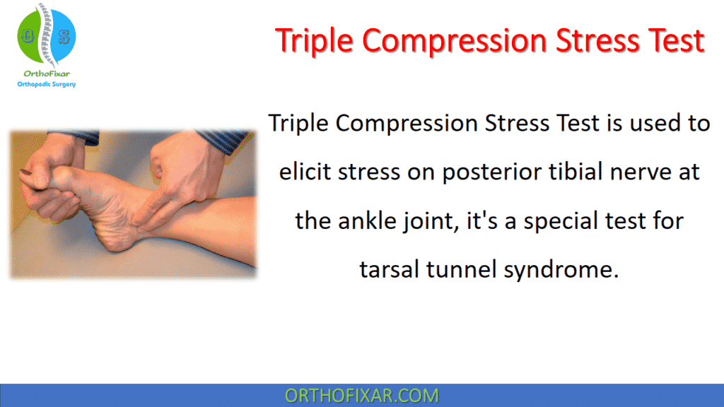 Triple Compression Stress Test Explained Easily | OrthoFixar
