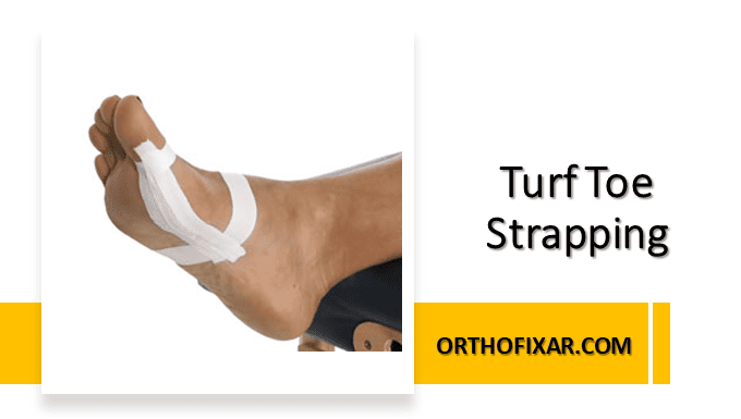 Turf Toe Strapping Technique | OrthoFixar