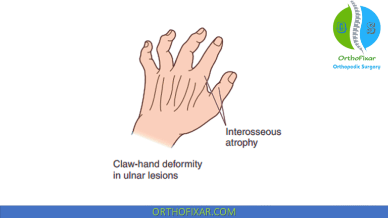 Ulnar Nerve Anatomy & Function | OrthoFixar