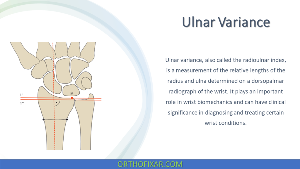 Ulnar Variance | Negative, Positive & Normal Values Explained Easily ...