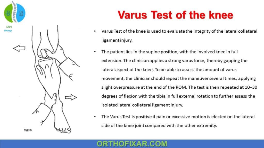 Varus Test Of The Knee Explained Easily | OrthoFixar