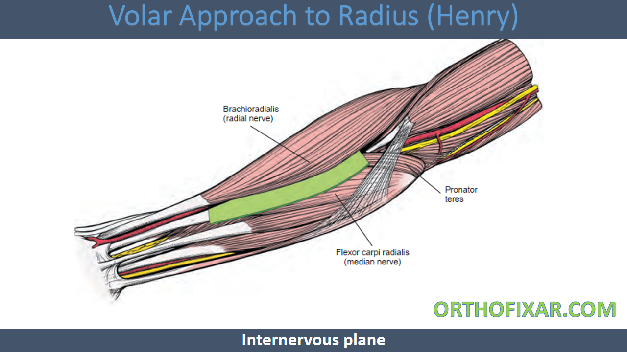 Volar Approach To Radius Easy Tutorial | OrthoFixar 2025