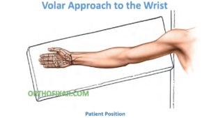 Volar Approach To The Wrist Easily Explained | OrthoFixar