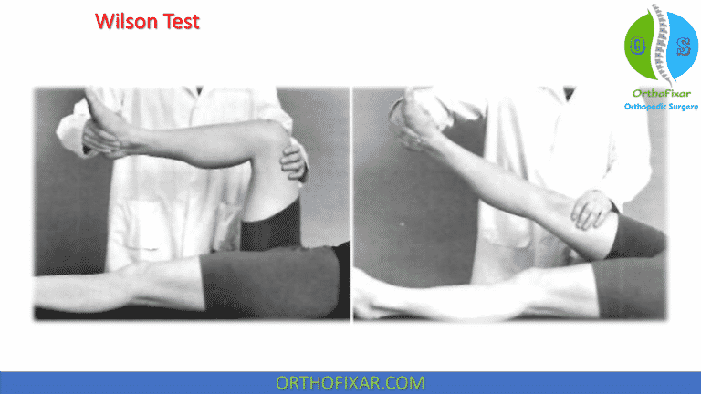 Wilson Test Overview - Easy Explained | OrthoFixar 2025