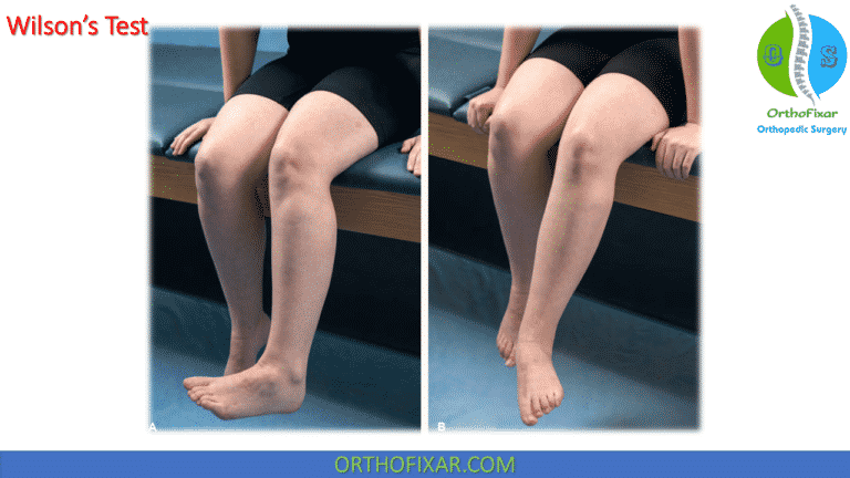 Wilson Test Overview - Easy Explained | OrthoFixar 2025