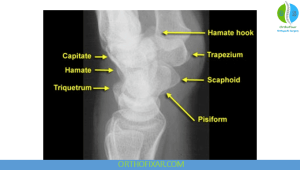 Wrist Radiology Imaging