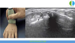 Wrist Ultrasound Imaging