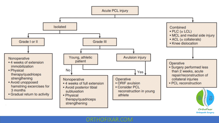 Knee PCL Injury | OrthoFixar