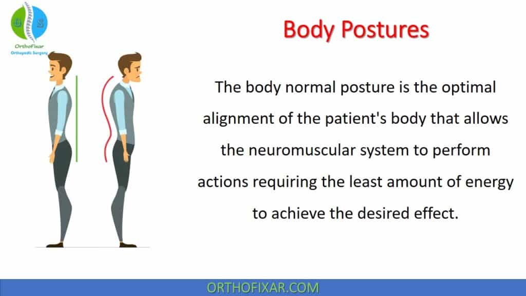 Body Postures Explained Easily | OrthoFixar