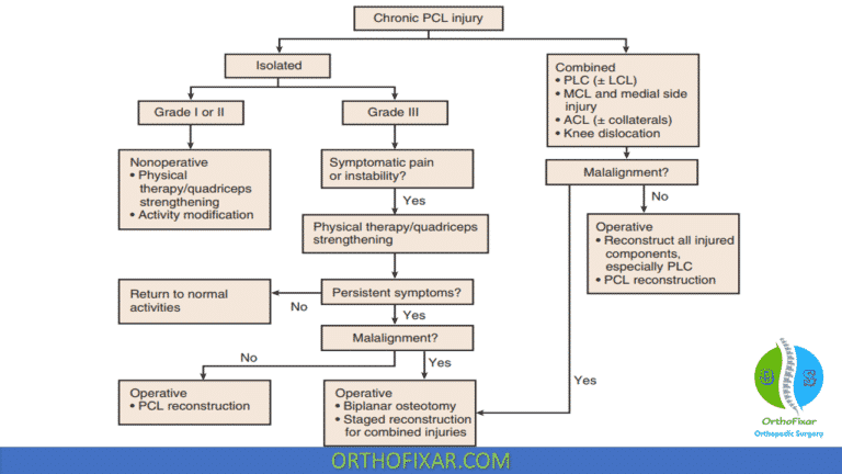 Knee PCL Injury | OrthoFixar