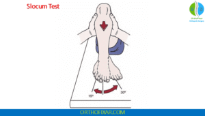 Knee Slocum Test Explained Easily | OrthoFixar