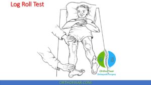 Log Roll Test Explained Easily | OrthoFixar