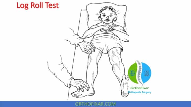 Log Roll Test Explained Easily | OrthoFixar