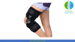 Knee MCL Sprain Overview | OrthoFixar 2026