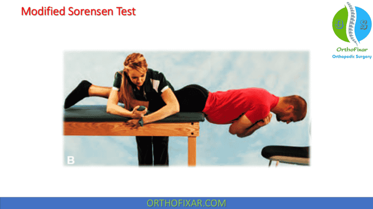 Sorensen Test Explained Easily | OrthoFixar
