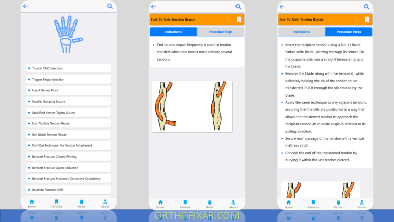 Orthopedic Surgery Techniques App | OrthoFixar