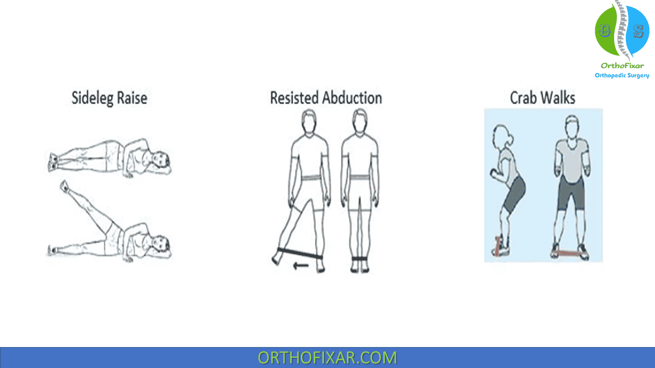 Osteitis Pubis | OrthoFixar