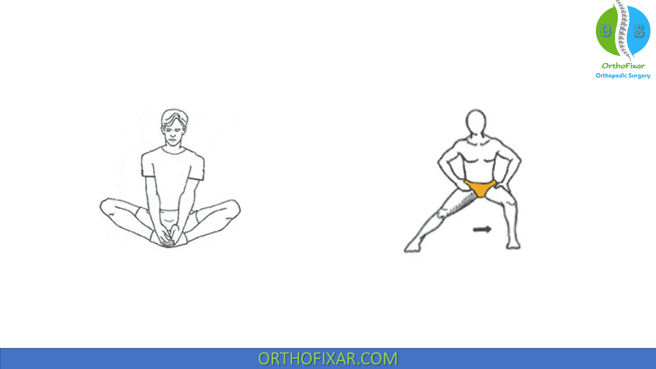 Osteitis Pubis | OrthoFixar