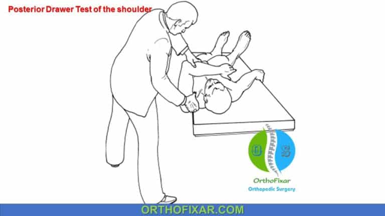 Posterior Drawer Test Of The Shoulder | OrthoFixar 2025
