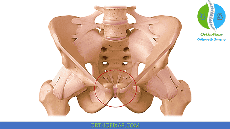Osteitis Pubis Orthofixar 2025