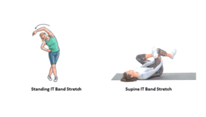 Tensor Fascia Lata Pain Treatment | OrthoFixar